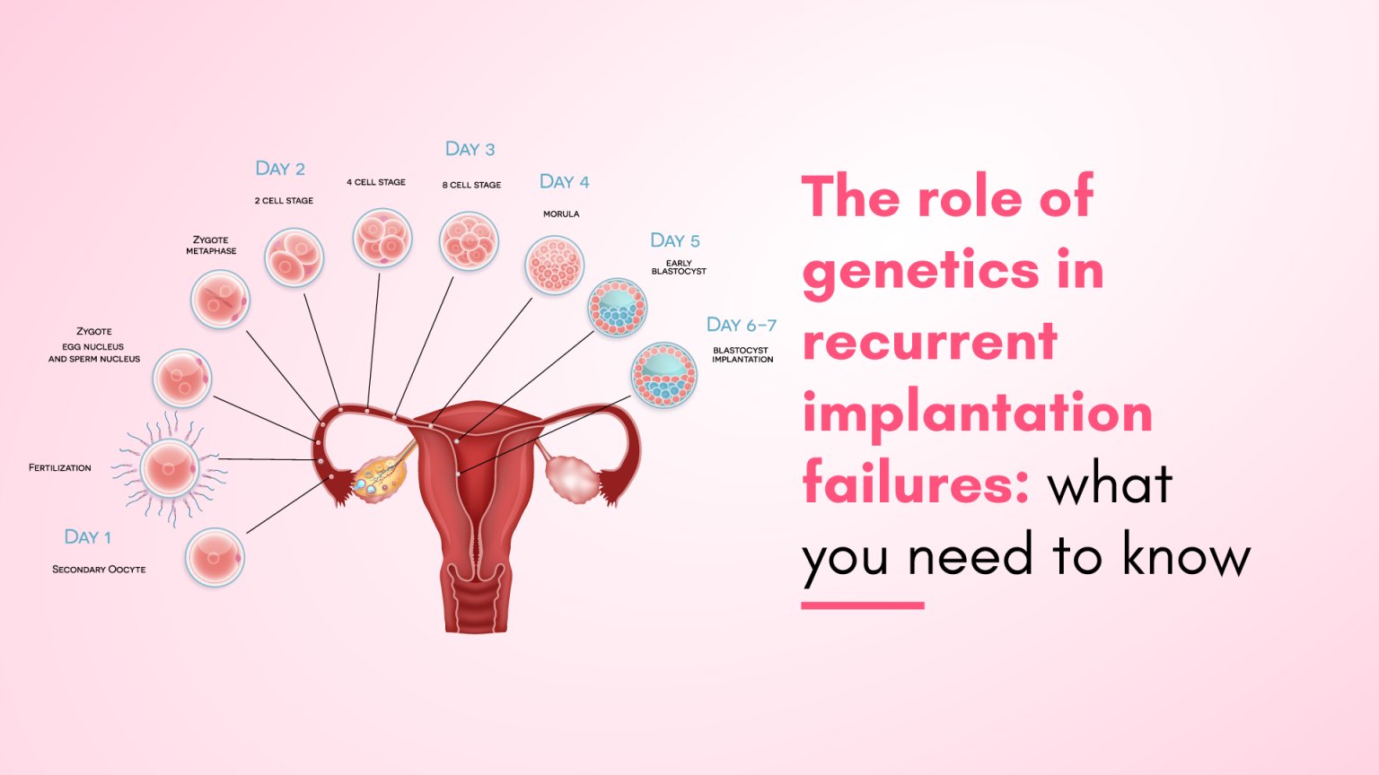 The Role of Genetics in Recurrent Implantation Failures